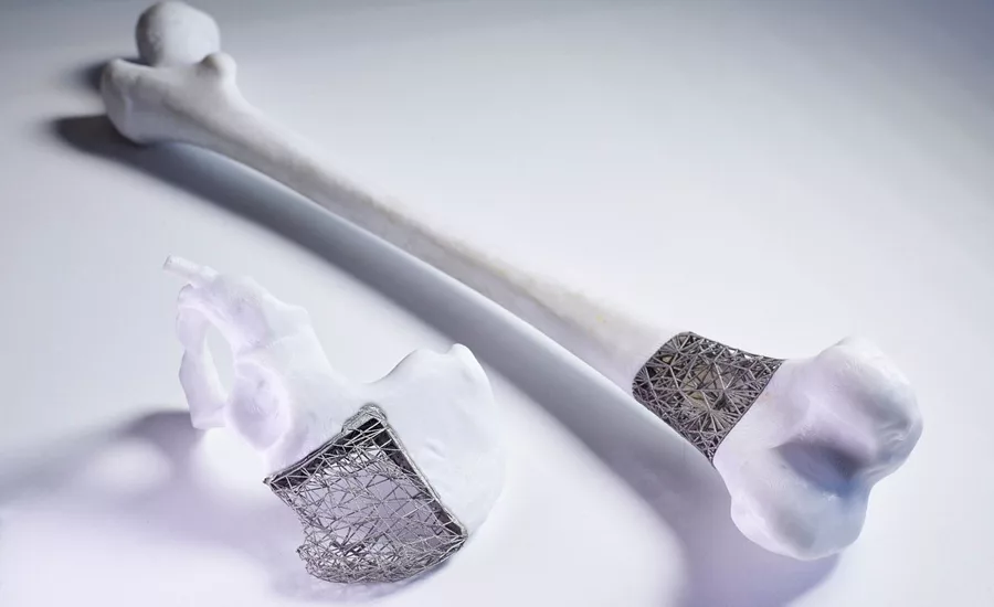Stryker Opens New Additive Manufacturing Facility in Ireland | ASSEMBLY